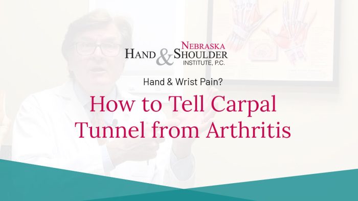 Carpal Tunnel Vs Hand Arthritis Know The Key Differences